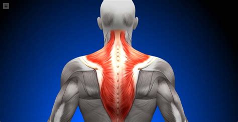 Síndrome miofascial causas síntomas y tratamientos Top Doctors