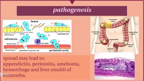 Parasitology Entamoeba Histolytica YouTube