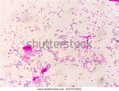 Gram Staining Known Grams Method Method Stock Photo