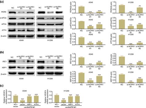 Knockdown Of NUPR1 Inhibits Angiogenesis In Lung Cancer Through IRE1