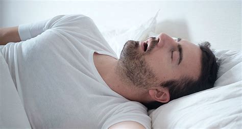 Apnea Del Sueño Síntomas Causas Y Tratamiento SoftDoc es