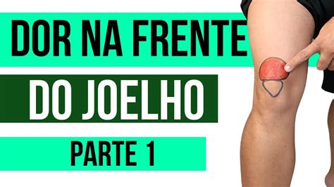 Como Melhorar A Dor Na Frente Do Joelho Parte Youtube