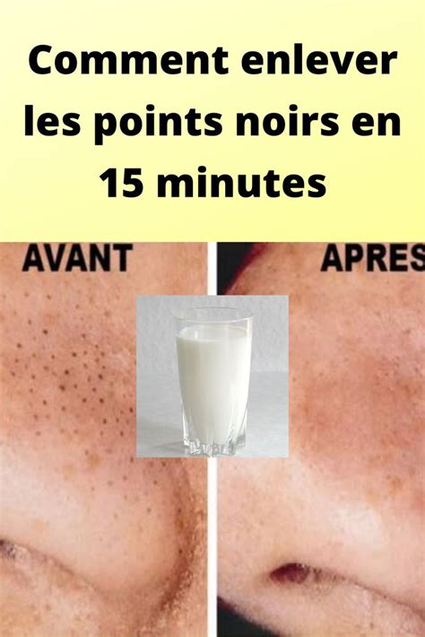 Comment Enlever Les Points Noirs En 15 Minutes Point Noir Soins De