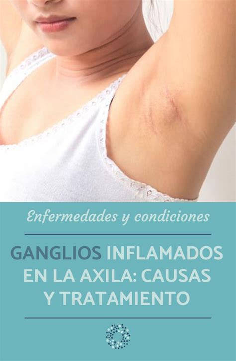 GANGLIOS Inflamados En La AXILA Causas Y Tratamiento Ganglios