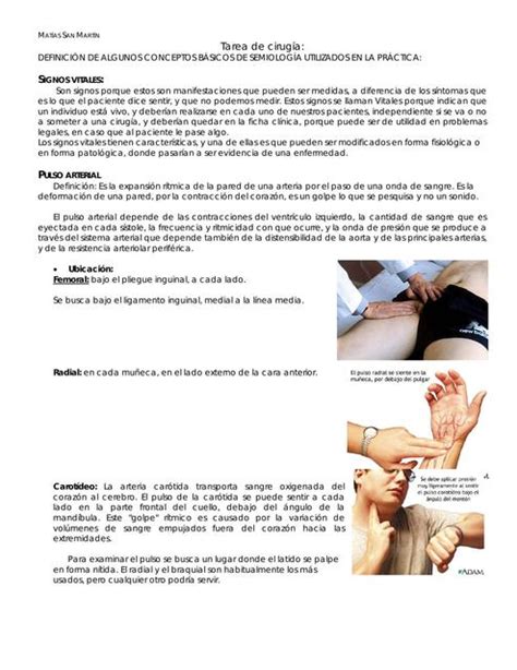 Definici N De Algunos Conceptos B Sicos De Semiolog A Yudoc Org Udocz