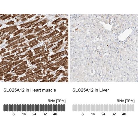 SLC25A12 Polyclonal Antibody Invitrogen 100 μL Unconjugated Fisher