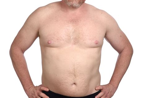Gynecomastia Guide Treatment Recovery Elegance Clinic