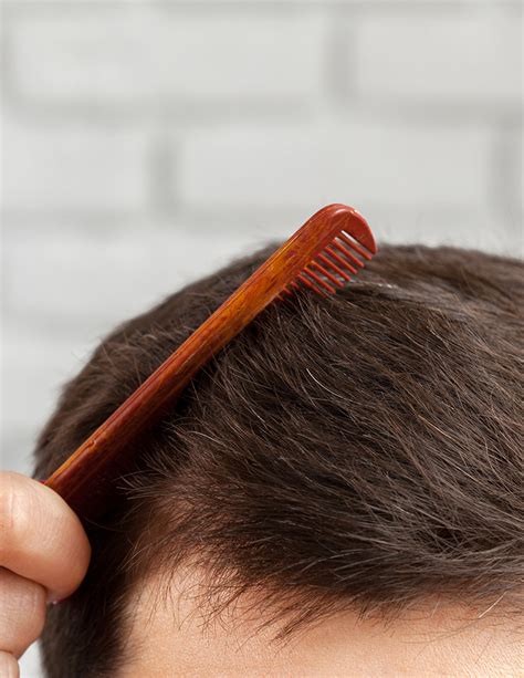 Prótesis capilares de pelo natural para hombre en Madrid