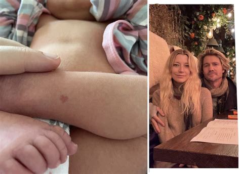 E Nata La Terza Figlia Di Chad Michael Murray Ed Ha Una Rara Voglia A