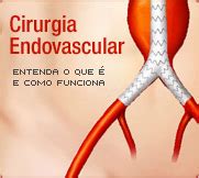 SITE Serviço Integrado de Técnicas Endovasculares Angiologia