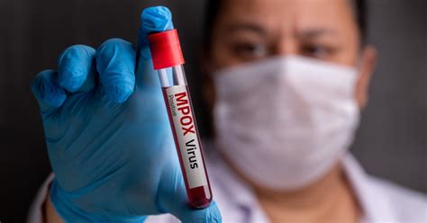 OMS Aprova Primeiro Teste De Mpox Para Uso Emergencial