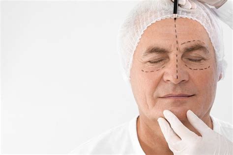 Rinoplastia Masculina Como A Cirurgia Pl Stica Para Homens
