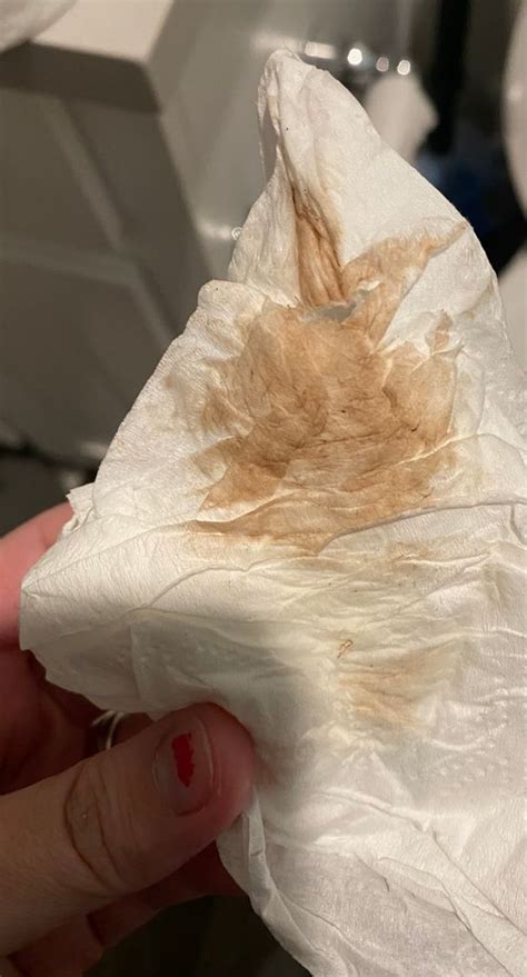 Implantation Bleeding Dark Brown