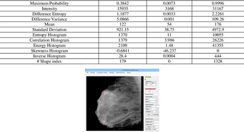 figure 1 from classification of breast masses in mammography images using a new hybrid of