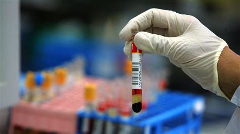 Cancer un médicament contre le myélome multiple multiplie par 7 la
