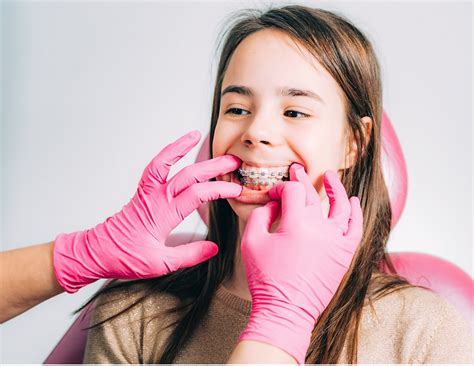 Qué Hacer si se te Despega un Bracket Guía Completa para Pacientes