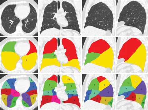 Automatic Segmentation Of Pulmonary Segments From Volumetric Chest Ct