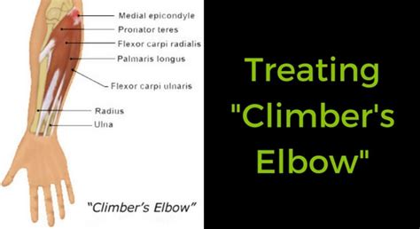 Treating Tendonitis Tendinosis For Climbers TrainingBeta