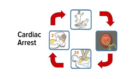 What Is The Medical Definition Of A Cardiac Arrest Printable