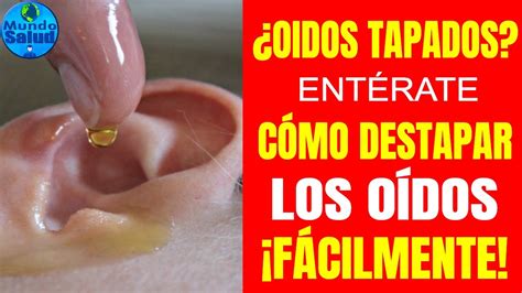 OIDOS TAPADOS MIRA Como Destapar Los Oidos Con Estos 3 Remedios