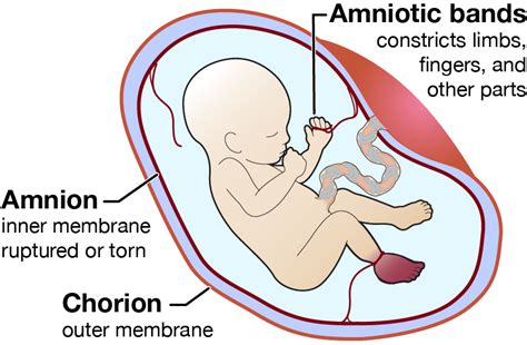 Chorion In Uterus