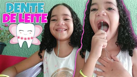 ARRANCANDO DENTE DE LEITE MOLE EM CASA COMO ARRANCAR DENTE DE LEITE