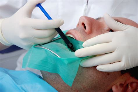 Endodoncia qué es y cómo se realiza Mavident Don Benito