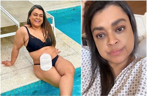 Preta Gil anuncia fim do tratamento contra câncer no intestino Coluna