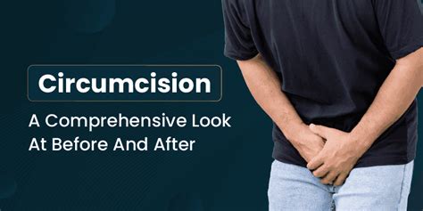 Circumcision A Comprehensive Look At Before And After