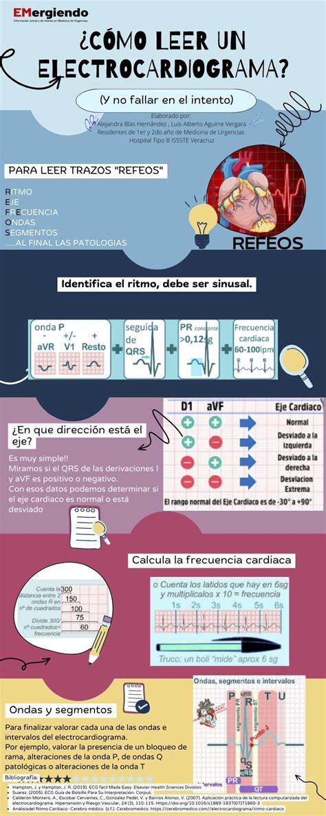 Cómo leer un electrocardiograma EMergiendo