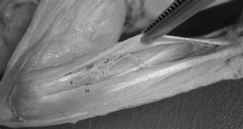 Lateral View Of The Right Forearm Of A Specimen The Superficial
