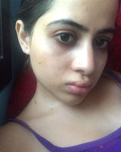 Urfi Javed Gets Unapologetically Real About Her Lips Filler Journey Read