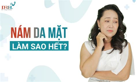Kinh nghiệm trị nám da mặt làm sao hết tại nhà hiệu quả DRH Clinic