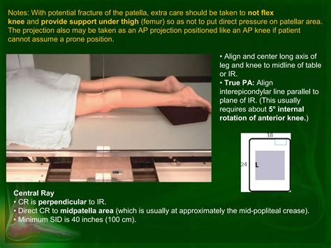 Advanced Radiographic Positions For The Lower Extremities Ppt