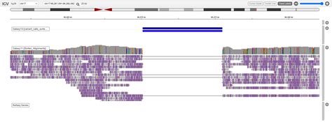 long read structural variant calling bioinformatics documentation