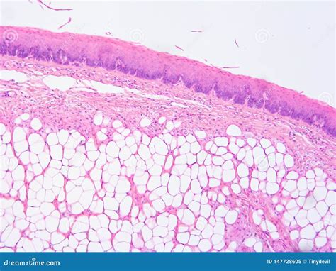 Histolog A Del Tejido Humano De La Epiglotis Imagen De Archivo Imagen