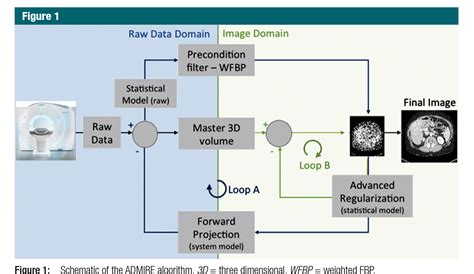 diagnostic performance of an advanced modeled iterative reconstruction algorithm for low