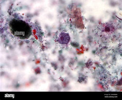 Entamoeba Histolytica Hi Res Stock Photography And Images Alamy