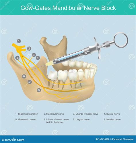 Inferior Alveolar Nerve Block Slidesharetrick