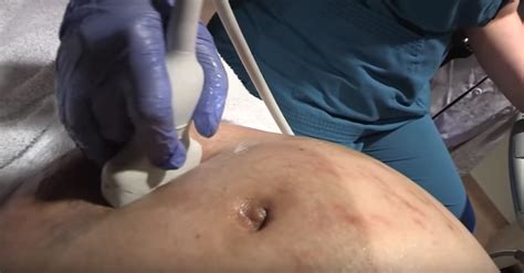 Giant Pregnant Belly Telegraph