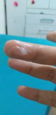 Corrimento Branco No Inicio Da Gravidez Maternidade Hospital