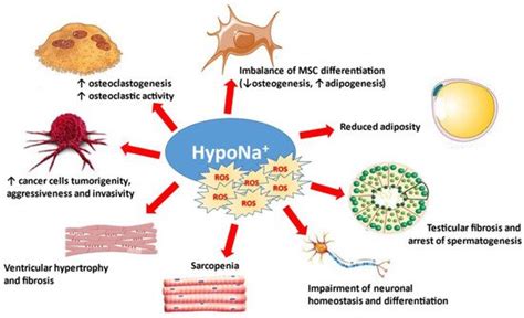 Hyponatremia And Non Osmotically Induced Oxidative Stress