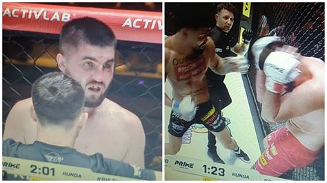 The Doctor Interrupted The Fight Of Don Kasjo Brutal Verification On