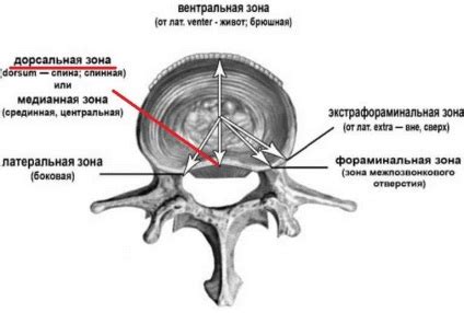 Dorsala Hernie De Disc Care Este Simptome Tratament