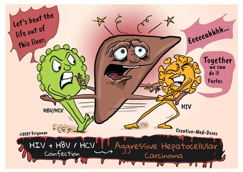 Hepatocellular Carcinoma Hiv Physician S Weekly