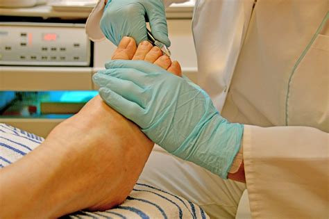 Infiltraciones para patologías del pie Clínica Fuensalud