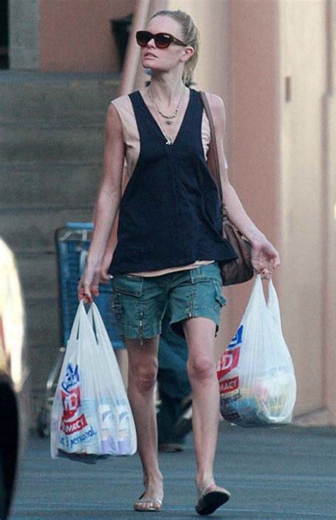 Weight Loss These Celebrities Are Too Skinny Stars That Are Too Skinny Hubpages