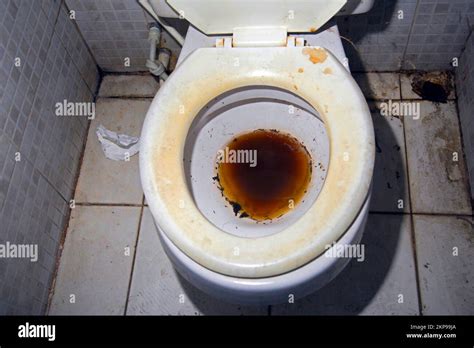 Worm In Toilet Hi Res Stock Photography And Images Alamy