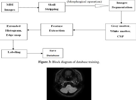 figure 3 from brain tumor segmentation and detection using firefly algorithm semantic scholar