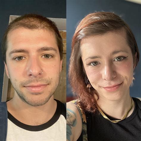 Best R Transtimelines Ffs Images On Pholder Face Comparison After